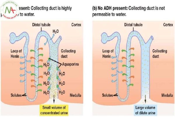 Hội chứng tiết hormon ADH không thích hợp: Cách chẩn đoán và điều trị