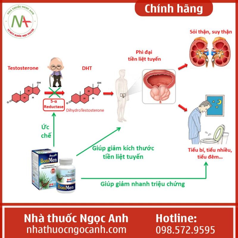 BoniMen 60 viên là thuốc hay thực phẩm chức năng, giá bao nhiêu, mua ở đâu