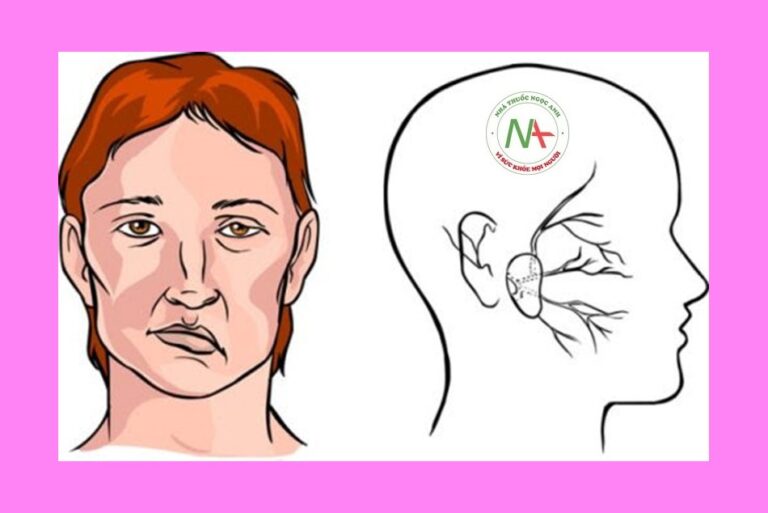 Zona thần kinh: Nguyên nhân, biến chứng, cách điều trị