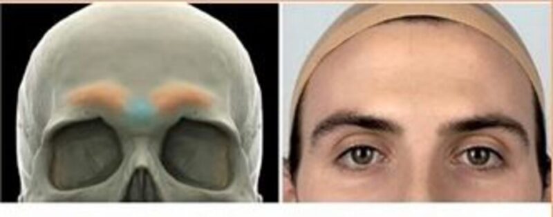 Giải phẫu khuôn mặt và ứng dụng trong phẫu thuật thẩm mỹ