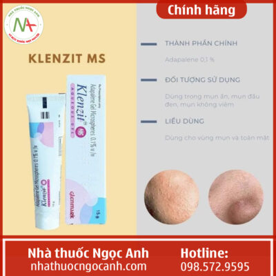 [CHÍNH HÃNG] Thuốc trị mụn trứng cá Klenzit MS có tốt không?