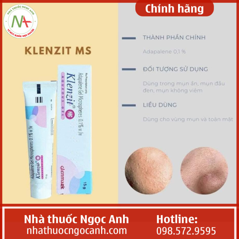 [CHÍNH HÃNG] Thuốc trị mụn trứng cá Klenzit MS có tốt không?