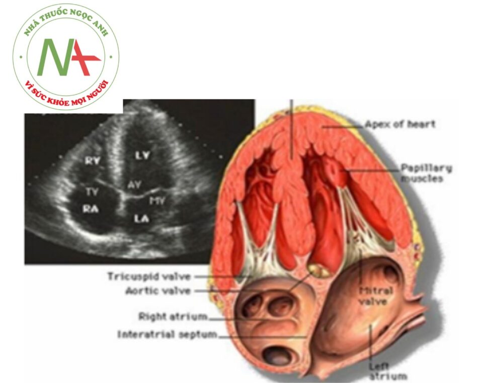 Những lưu ý và các phương pháp siêu âm tim trong lâm sàng tim bẩm sinh