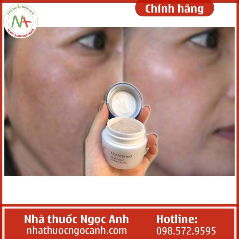 Kem dưỡng trắng da Transino Whitening Repair Cream EX có tốt không, giá ...