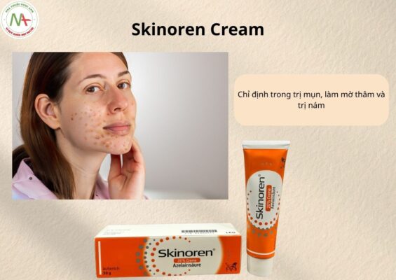 Skinoren Cream có đẩy mụn không, giá bao nhiêu, mua ở đâu chính hãng?