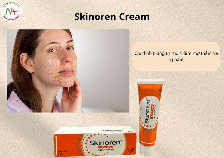 Skinoren Cream có đẩy mụn không, giá bao nhiêu, mua ở đâu chính hãng?