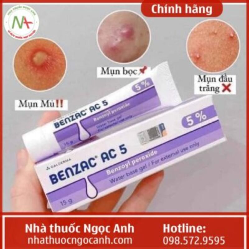 Thuốc Benzac AC 5 % có tác dụng gì, có tốt không, giá bao nhiêu, mua ở đâu?