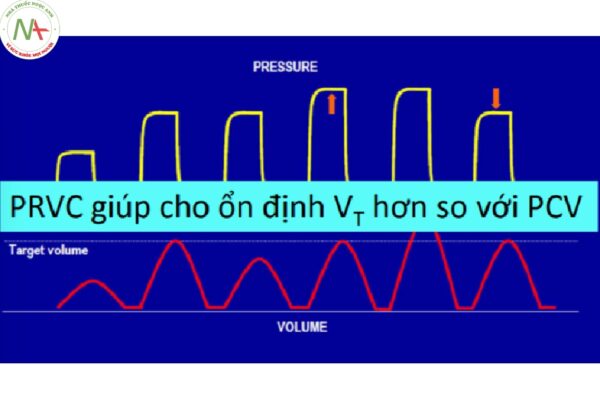 ALGORITHM cài đặt máy thở ban đầu cho bệnh nhân ARDS