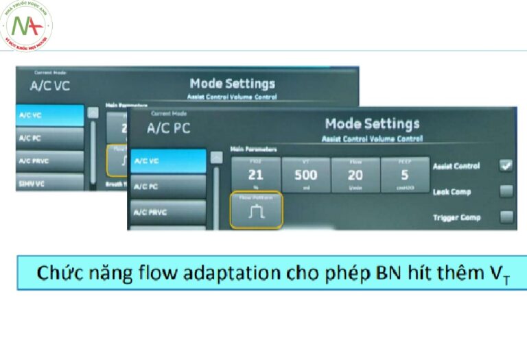 ALGORITHM cài đặt máy thở ban đầu cho bệnh nhân ARDS