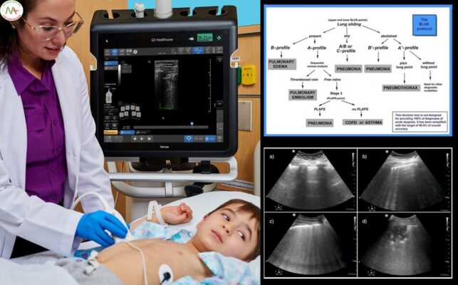 Siêu âm phổi ở bệnh nhân nặng: BLUE Protocol