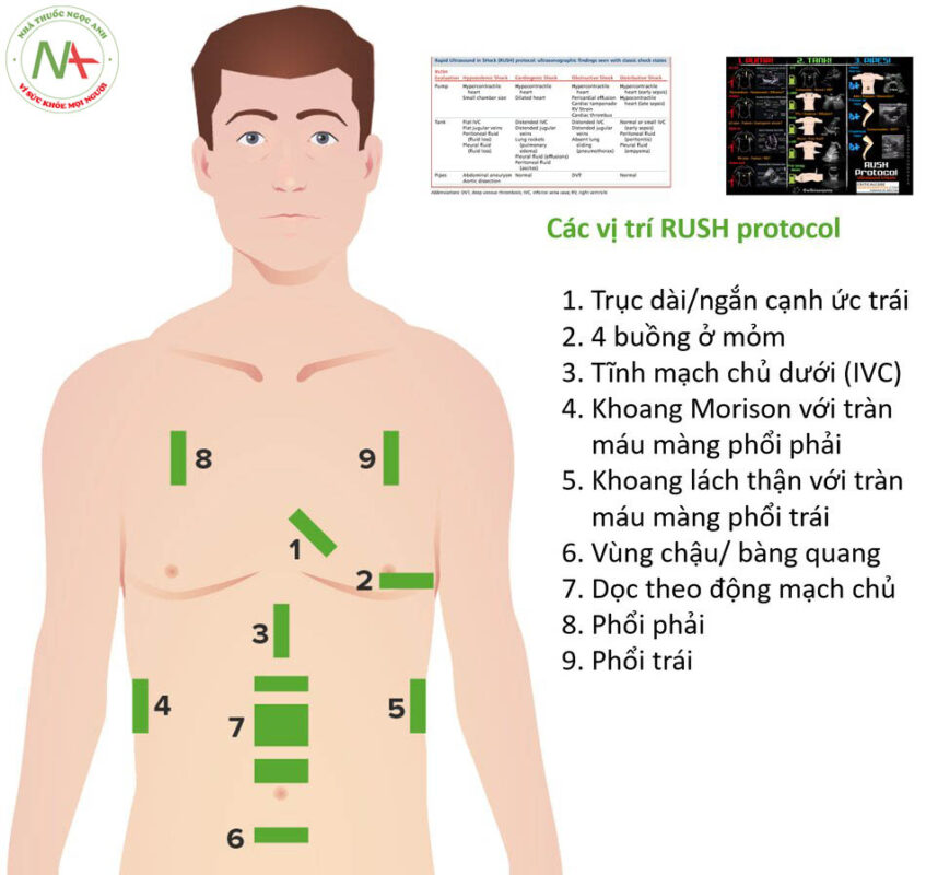 Rapid Ultrasound for Shock and Hypotension - Siêu âm nhanh trong sốc và ...