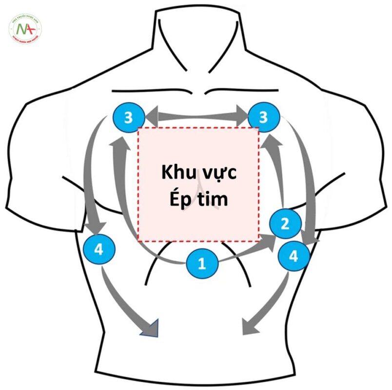 SESAME protocol và POCUS-CA siêu âm tại chỗ trong ngừng tim