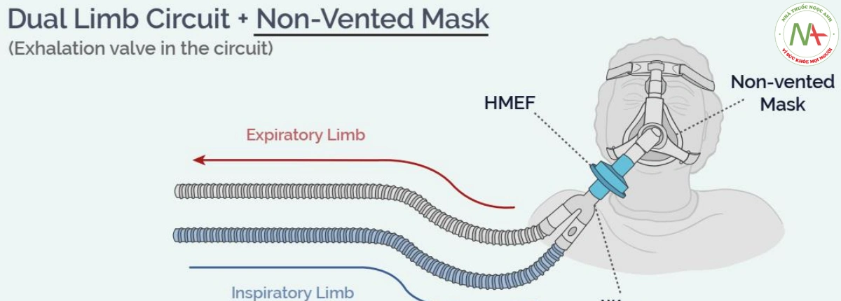 SỬ DỤNG LÀM ẨM NHIỆT - HME - BỘ LỌC HÔ HẤP TRONG THÔNG KHÍ nhân tạo tại ICU
