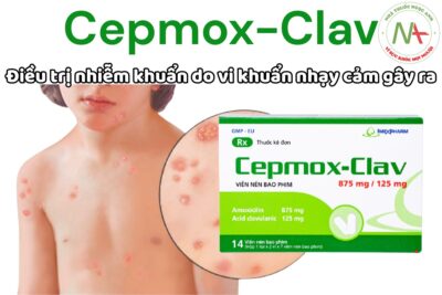 Thuốc Cepmox-Clav 875mg/125mg là thuốc gì, công dụng, giá bao nhiêu ...