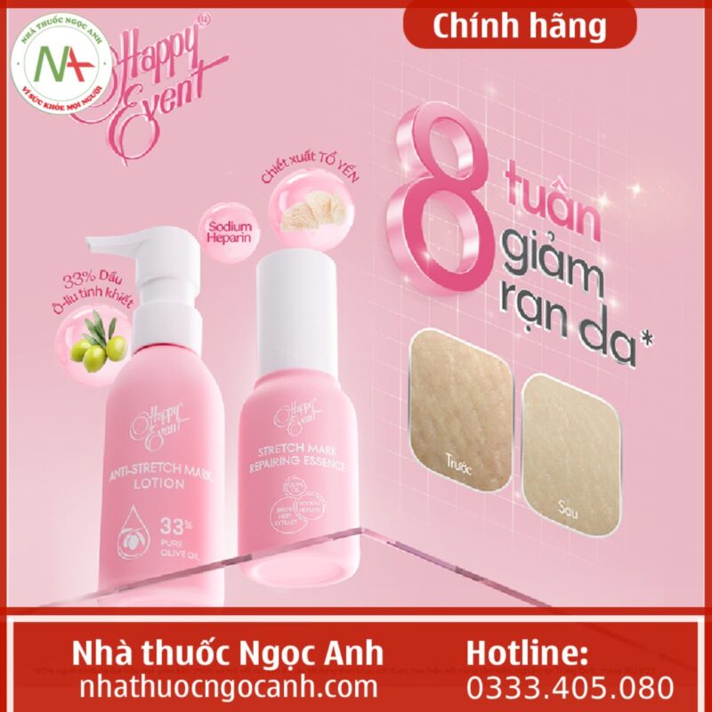 Happy Event Anti-Stretch Mark Lotion là gì? Giá bao nhiêu? Mua ở đâu?