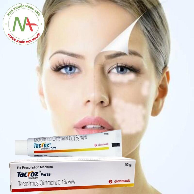 Bệnh bạch biến là gì? Các thuốc trị bạch biến tận gốc hiệu quả nhất ...