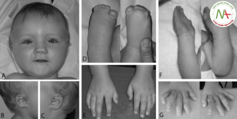 Bệnh Học - Kiến thức Y học cơ sở - nhà thuốc Ngọc Anh