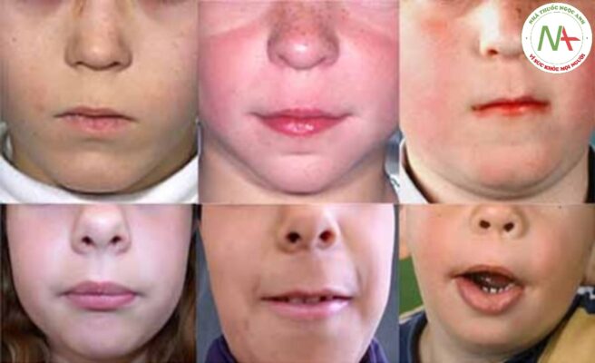 Bệnh Học - Kiến thức Y học cơ sở - nhà thuốc Ngọc Anh