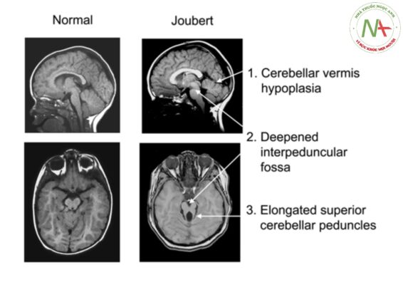 Bệnh Học - Kiến thức Y học cơ sở - nhà thuốc Ngọc Anh